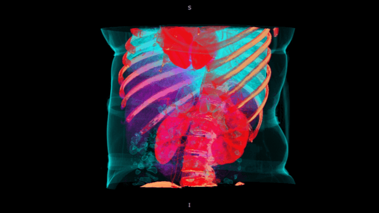 PET Scan Vs CT Scan: Similarities And Differences