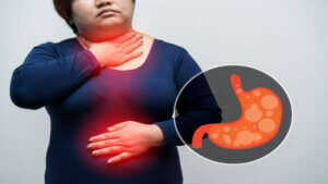 How Long Does GERD Last | Duration, Flare Ups, And Relief Guide